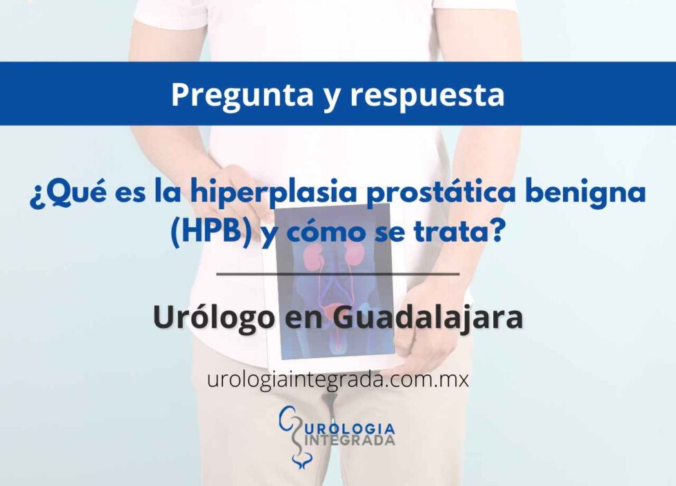 ¿Qué es la hiperplasia prostática benigna (HPB) y cómo se trata ...